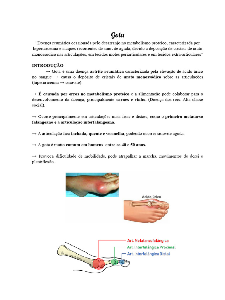 Gota e Pseudogota Resumofisio | PDF | Gota | Doenças e distúrbios