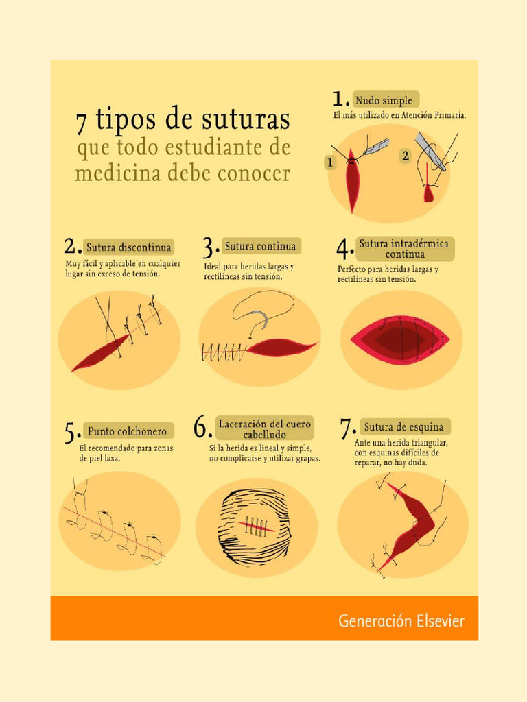 tipos de suturas | PDF