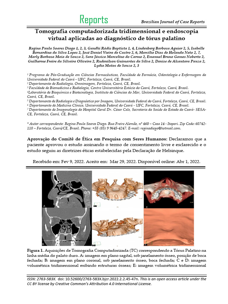 Tomografia Computadorizada Tridimensional e Endoscopia Virtual ...