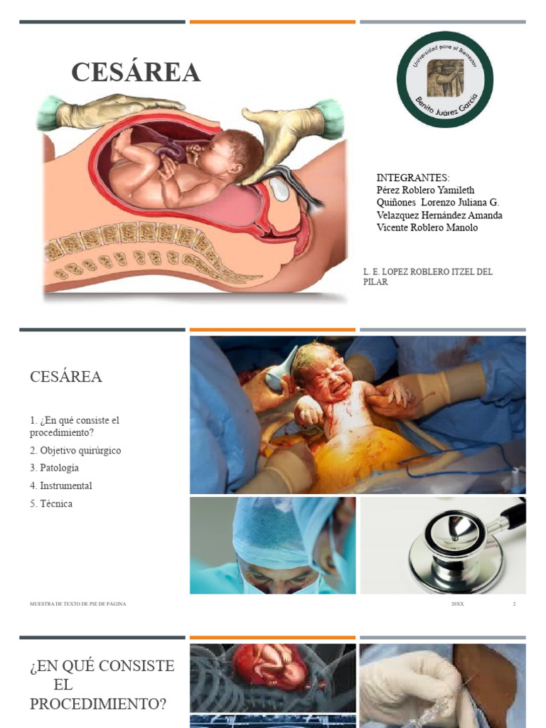 Parto Cesarea Diapositivas | PDF