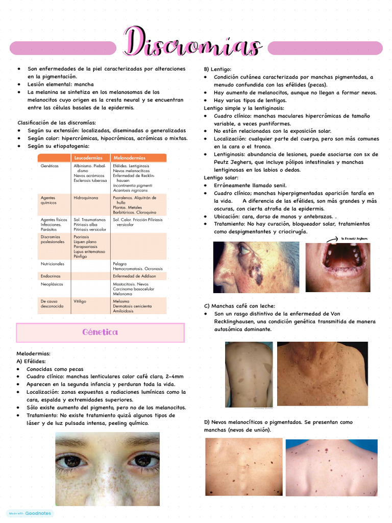 Discromías | PDF | Glándula suprarrenal | Piel