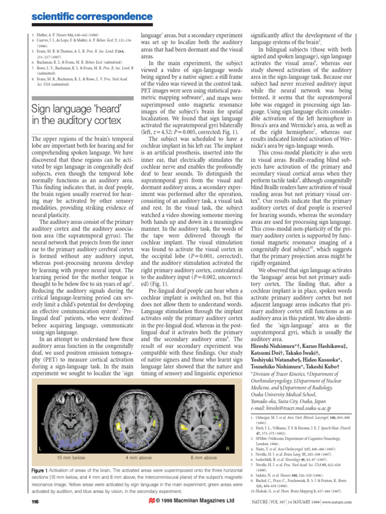 Sign Language Heard' in The Auditory Cortex: Scientific Correspondence ...