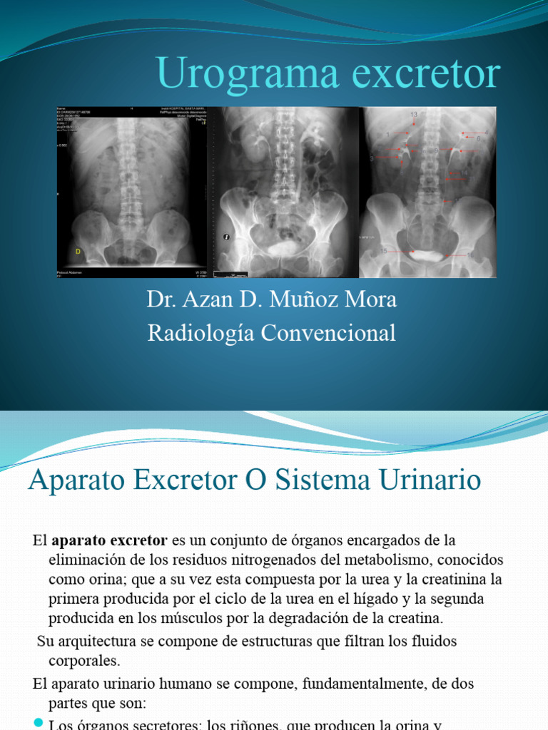 Urograma Excretor: Procedimiento y Anatomía | PDF | Riñón | Sistema ...