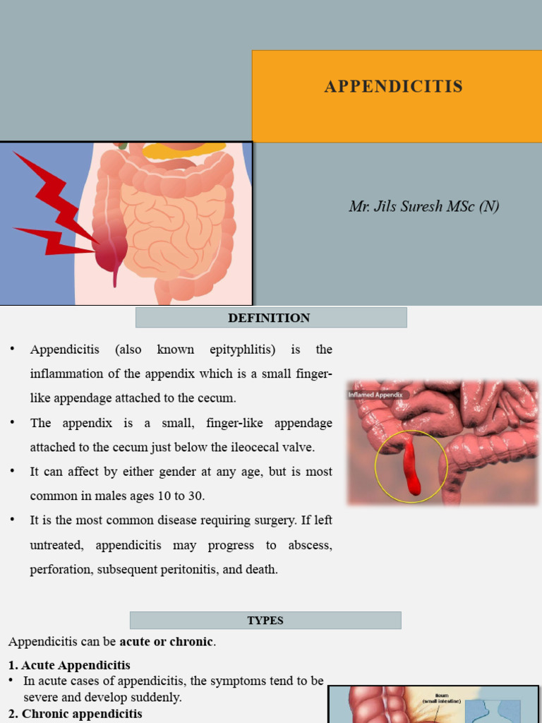 Appendicitis | PDF