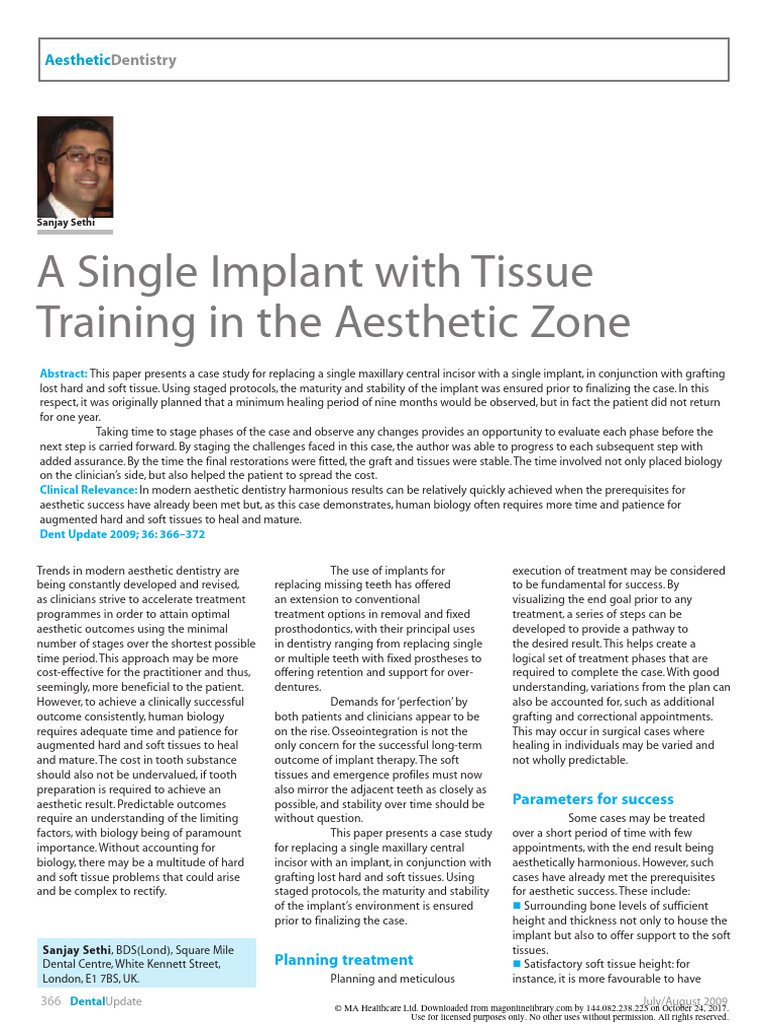 Single Implant Aesthetic Dentistry Case Study | PDF | Dental Implant ...