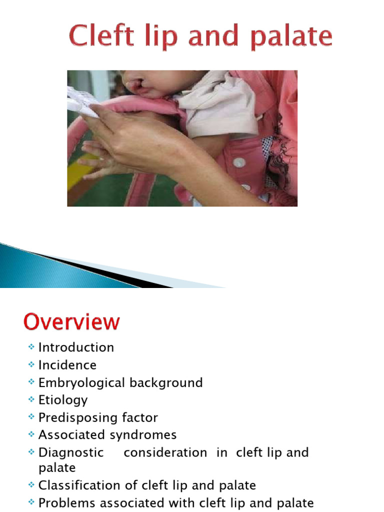 Cleft Lip and Palate | PDF | Orthodontics | Mouth