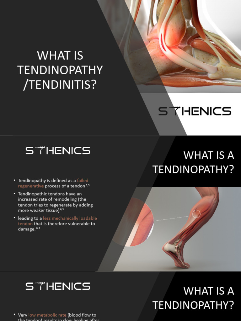 Understanding Tendinopathy in Athletes | PDF | Clinical Medicine ...