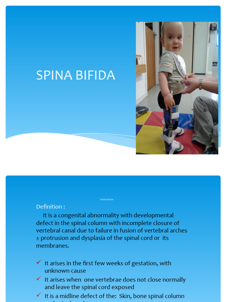 Understanding Spina Bifida: Types & Care | PDF