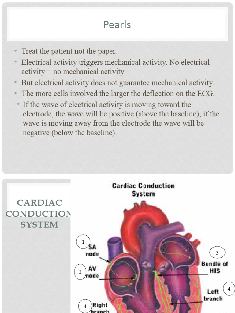 ECGs The Basics (Part 1) Lecture | PDF | Electrocardiography | Heart