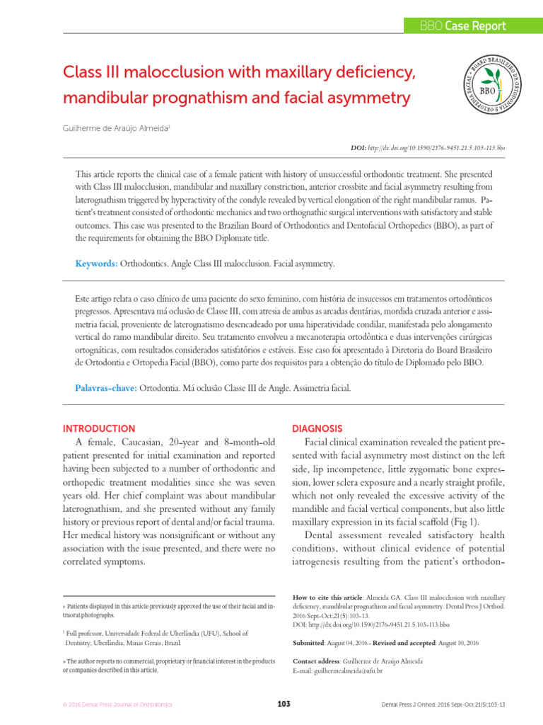 Class Iii Malocclusion With Maxillary Deficiency Mandibular