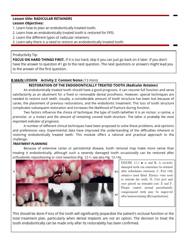 Radicular Retainers: Restoration Guide | PDF | Human Tooth | Tooth