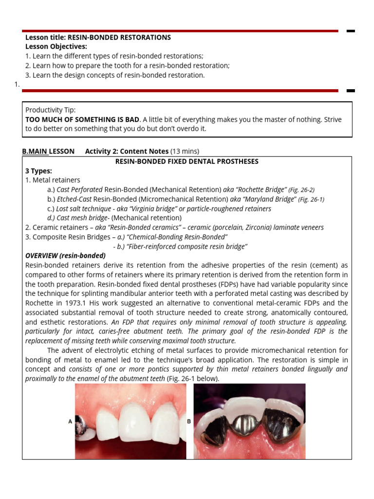 FPD - lec.SAS.14 Resin Bonded Retainer | PDF
