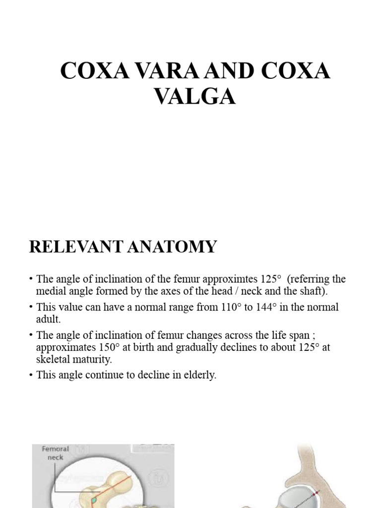 Coxa Vara and Coxa Valga | Download Free PDF | Hip | Skeletal System