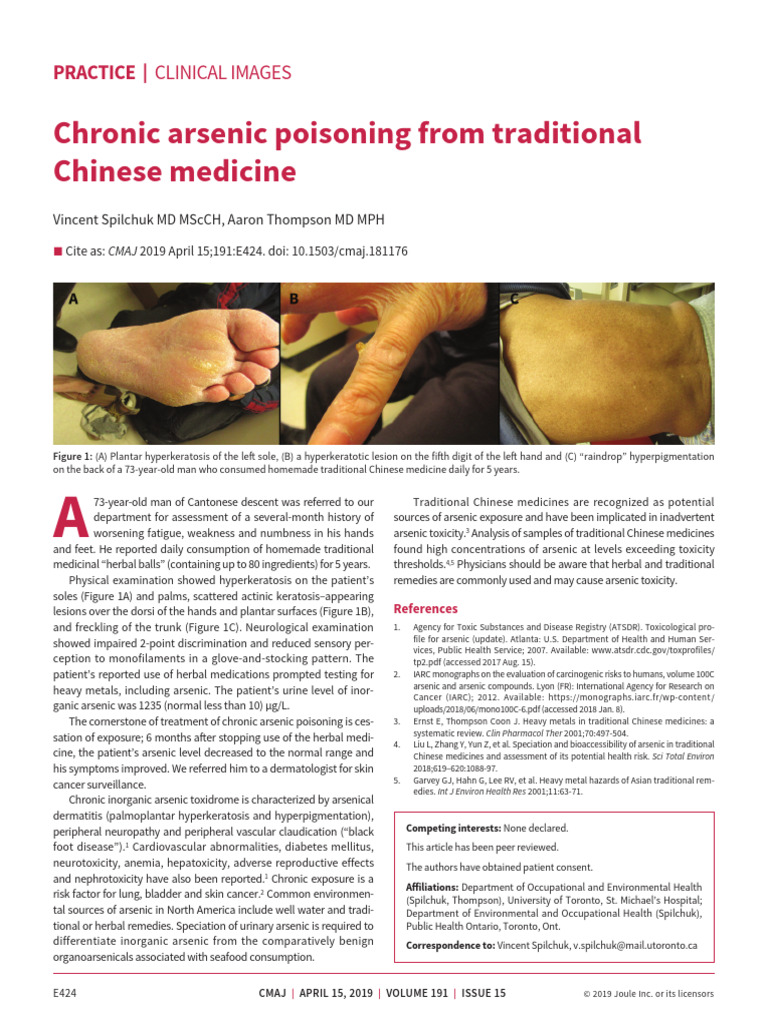 Chronic Arsenic Poisoning From Traditional Chinese Medicine | PDF ...