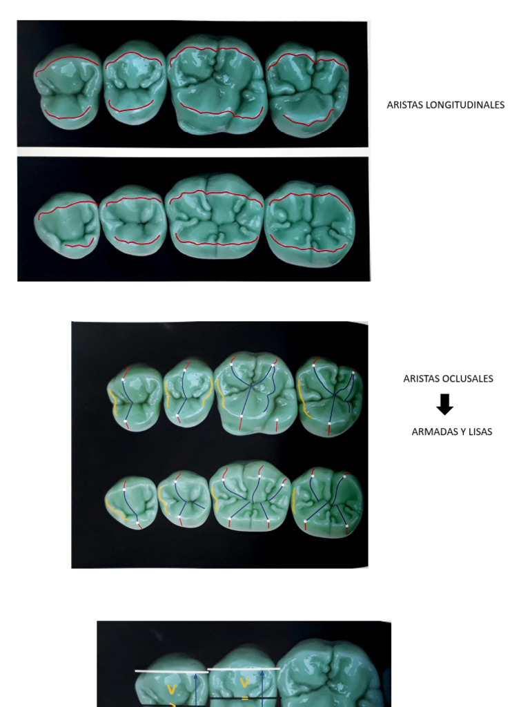 Anatomía de Aristas y Surcos Dentales | PDF | Ciencia y matemáticas ...