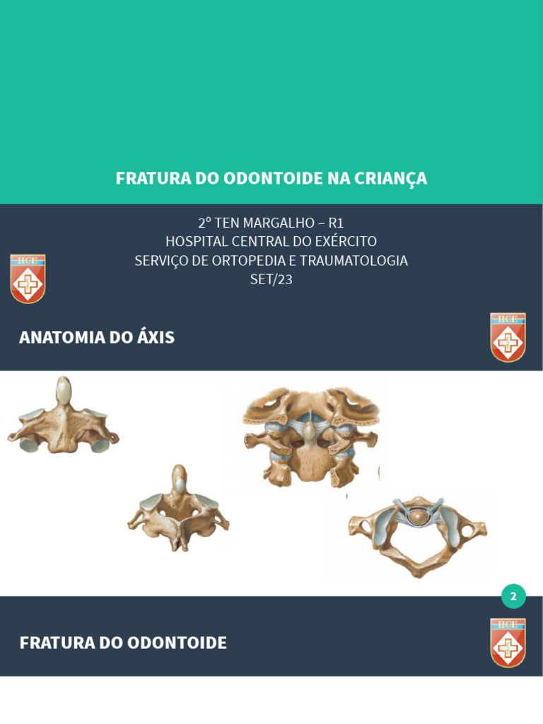 FX Odontoide | PDF