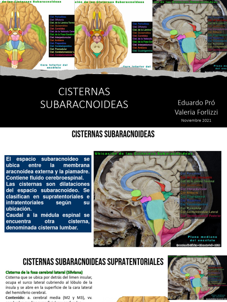 Pro Forlizzi Cisternas | PDF | Cerebelo | Anatomía