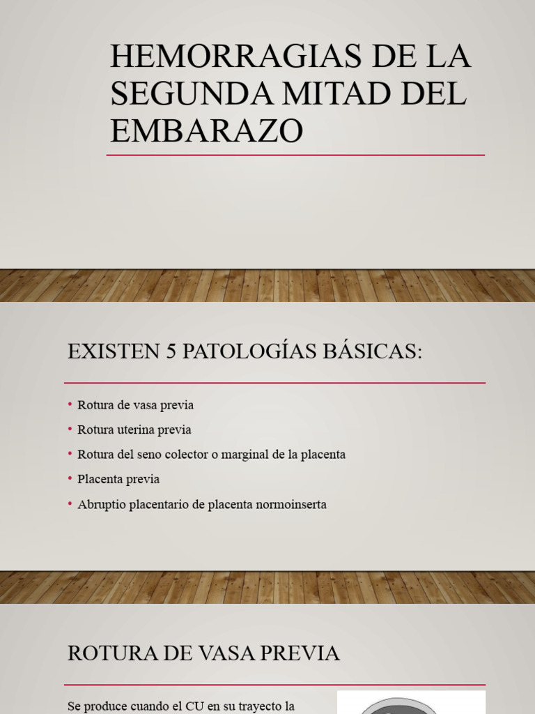 Hemorragias de La Segunda Mitad Del Embarazo. | PDF | Placenta ... Hemorragias de La Segunda Mitad Del Embarazo. | PDF | Placenta ...