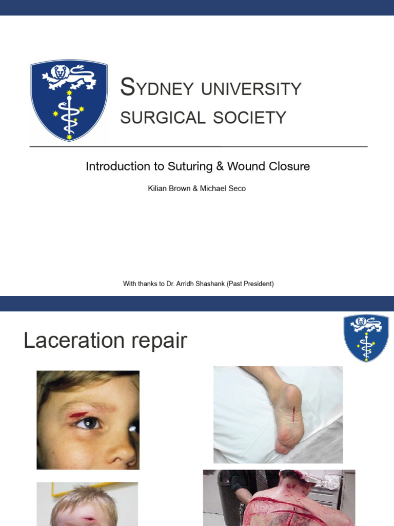 Sutures | PDF | Surgical Suture | Wound