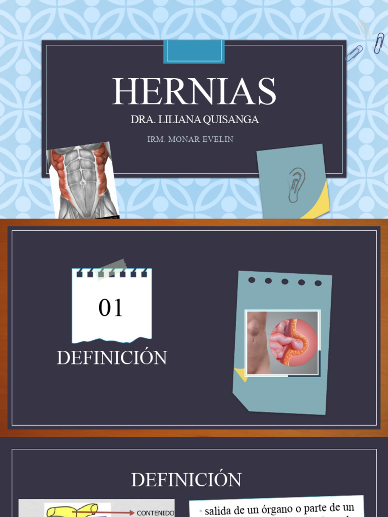 Tipos y Tratamientos de Hernias Abdominales | PDF | Abdomen | Anatomía