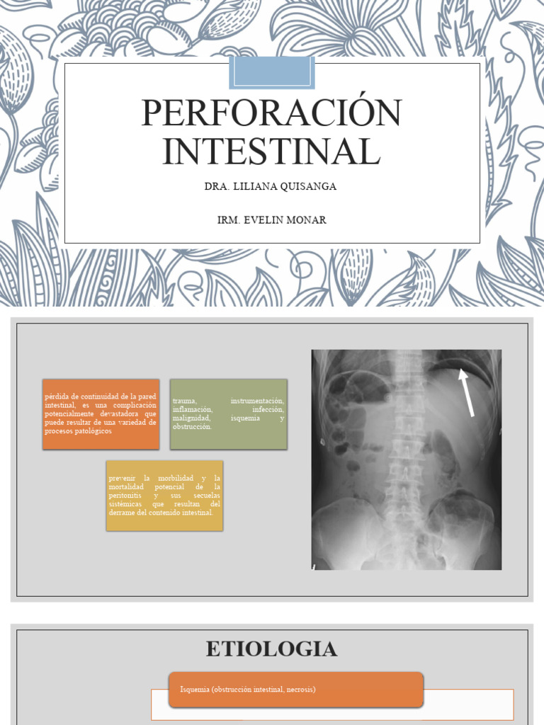 Perforación Intestinal | PDF | Cáncer | Medicina CLINICA