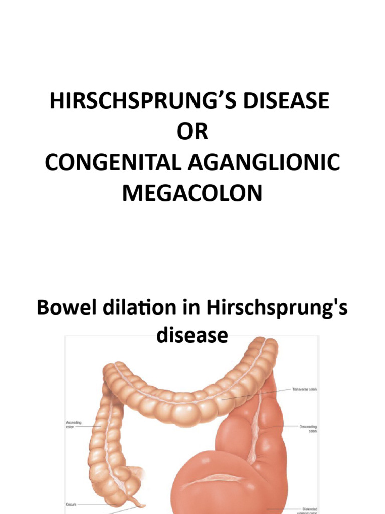 Hirschsprung'S Disease OR Congenital Aganglionic Megacolon | PDF ...