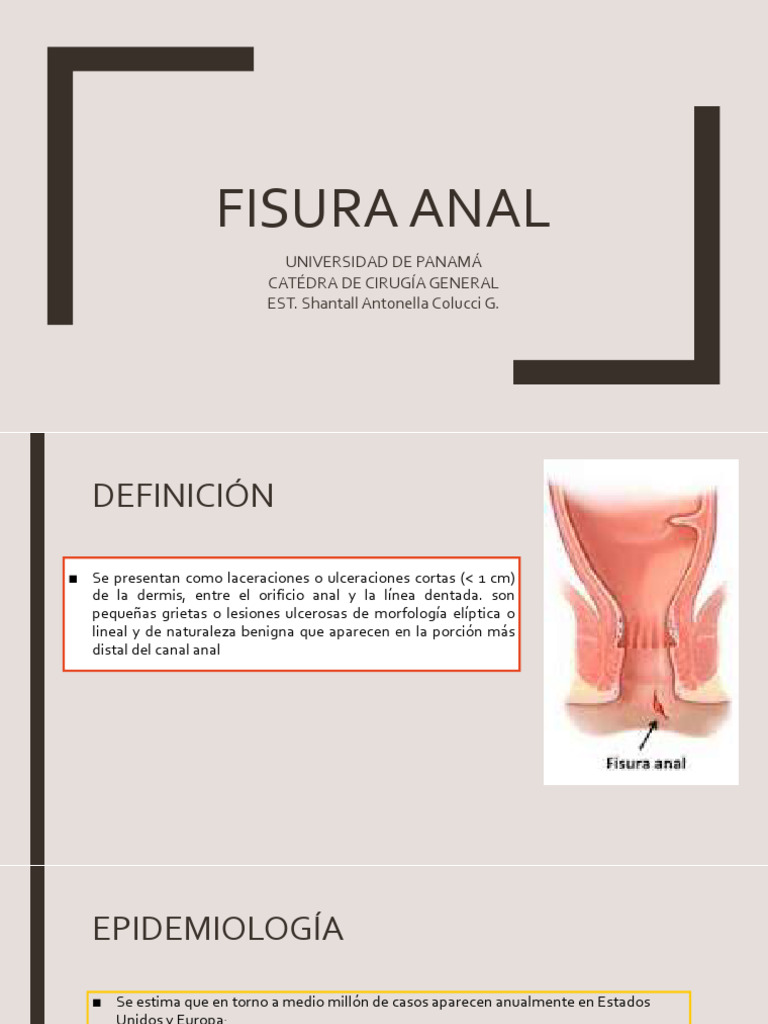 fisura anal | PDF