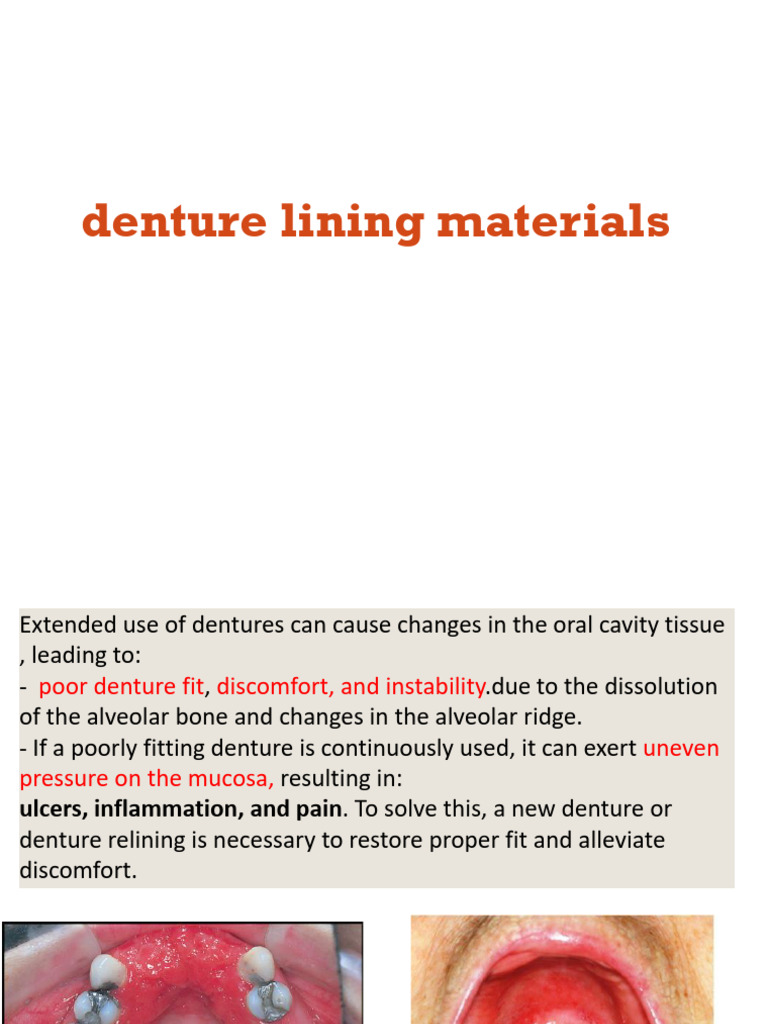 Soft and Hard Denture Relining Materials | PDF | Dentures | Poly(Methyl ...