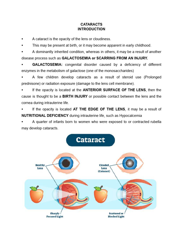 CATARACTS | PDF | Cataract | Human Eye