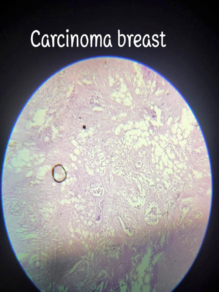 Histopathology Slides Pdf