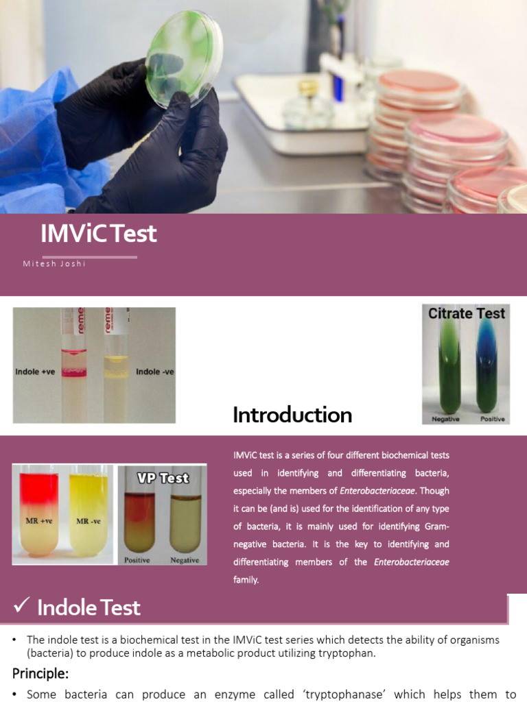 Imvic Test LAB | PDF