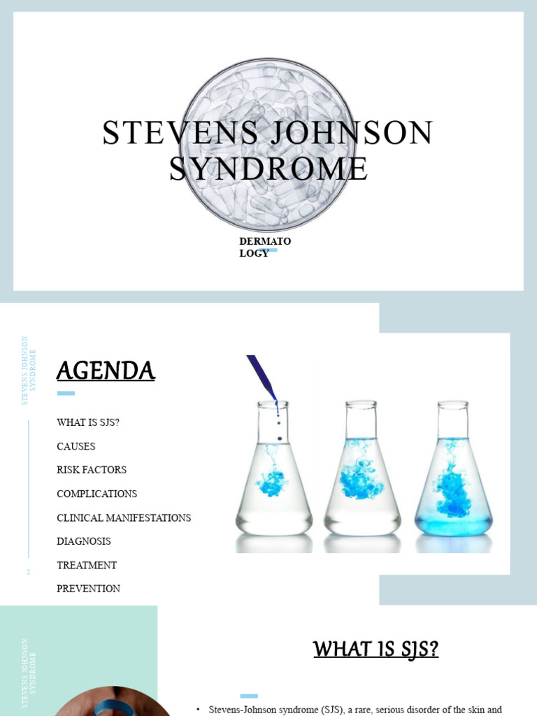 Stevens Johnson Syndrome: Dermato Logy | PDF | Epidemiology | Diseases ...