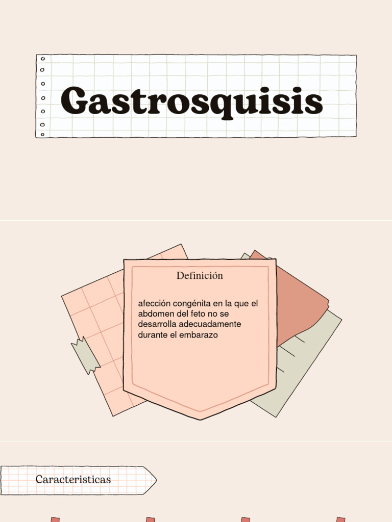 Gastrosquisis Presentacion | PDF | Abdomen | El embarazo