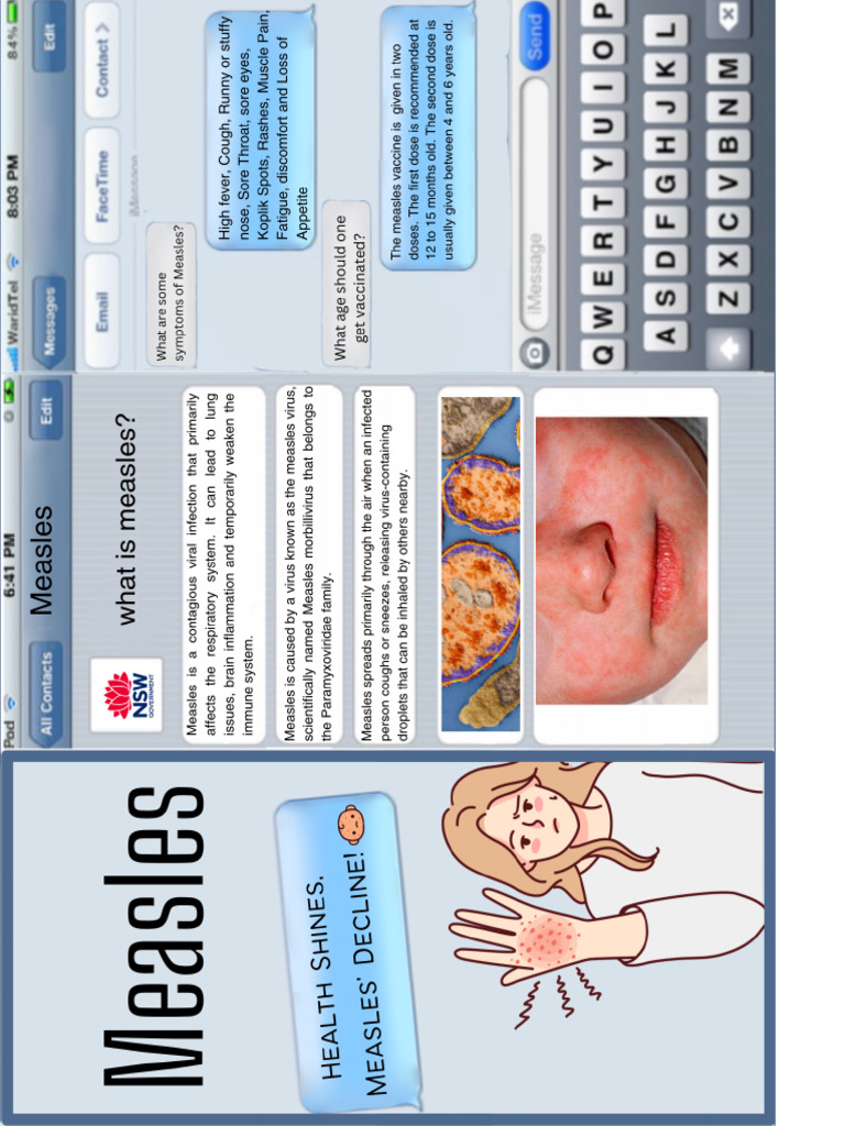 Measles Brochure | PDF