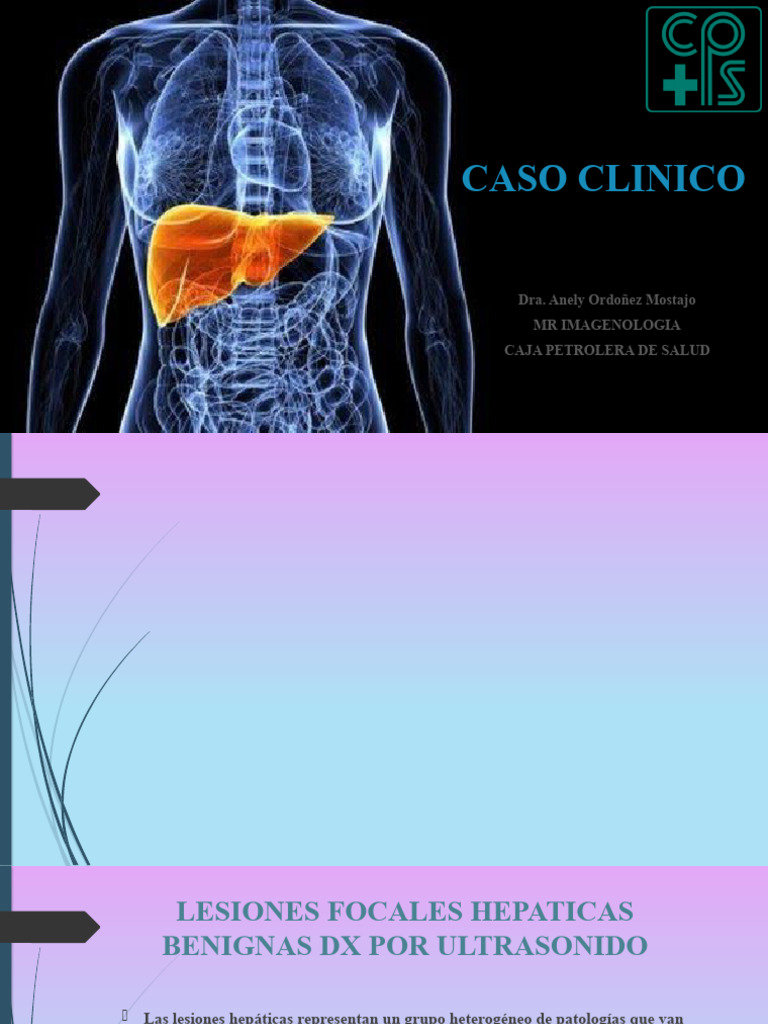 Caso Clinico Lesiones Hepaticas Simples | PDF | Neoplasias | Metástasis