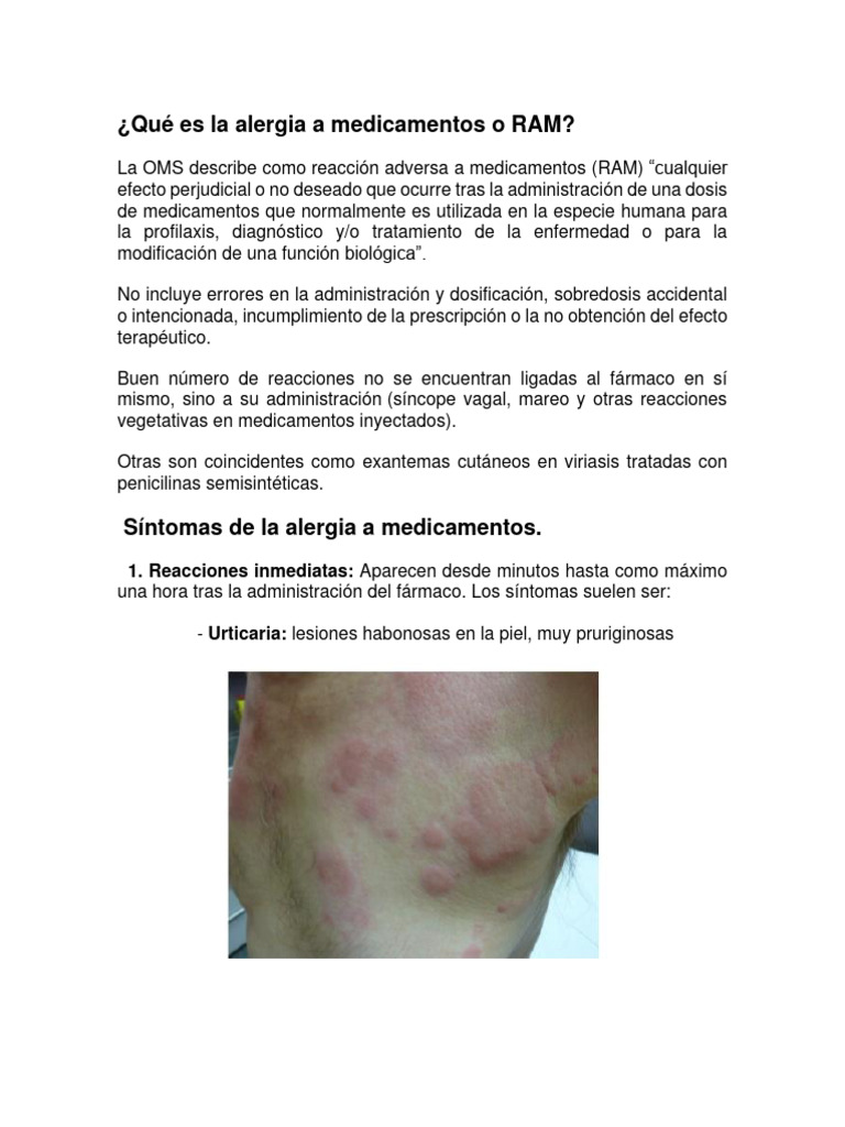 Alergia Medicamentosa | PDF | Alergia | Medicamentos con receta