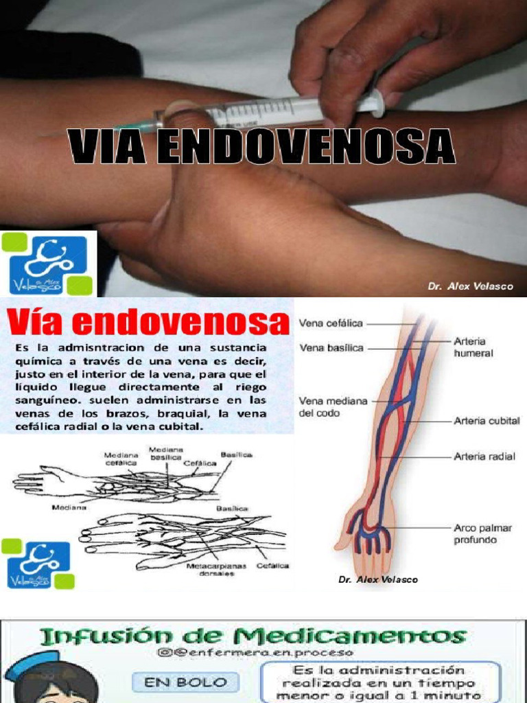 Via Endovenosa | PDF