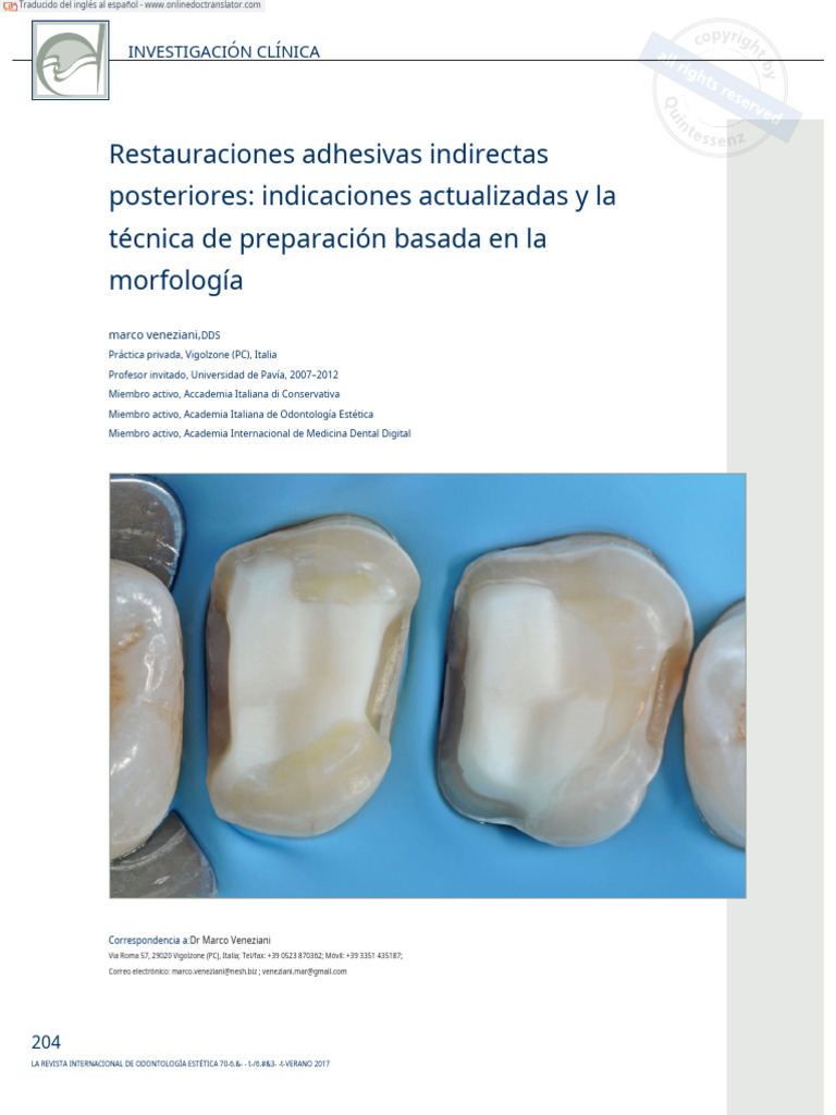 Posterior Indirect Adhesive Restorations Updated Indications And The Morphology Driven