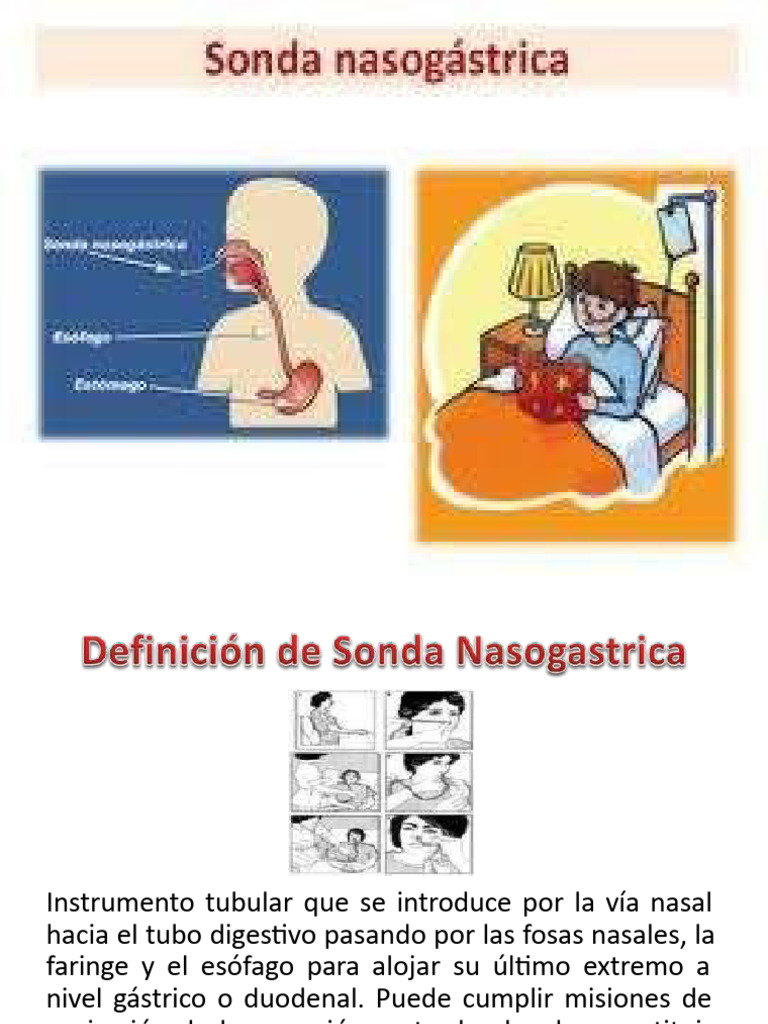 Sonda Nasogastrica q10 | PDF