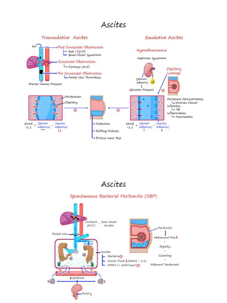 Ascites: Exudative Ascites Transudative Ascites | PDF | Cardiovascular ...