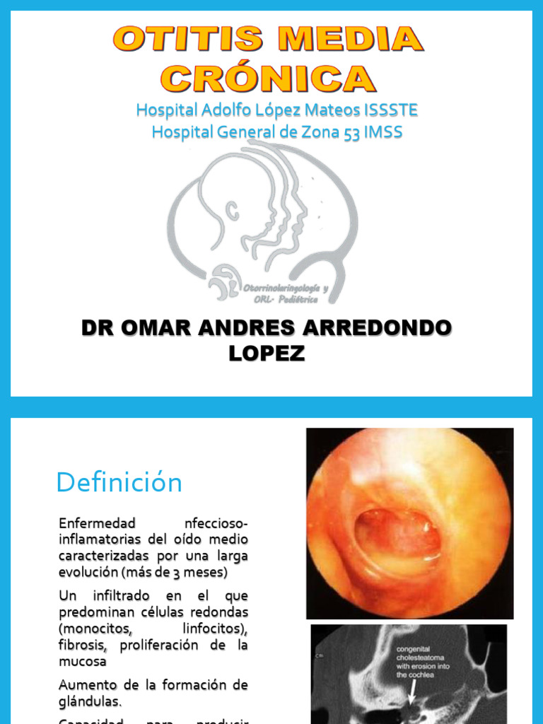 2.7 D - Otitis Media Cronica | PDF | Otorrinolaringología | Inflamación