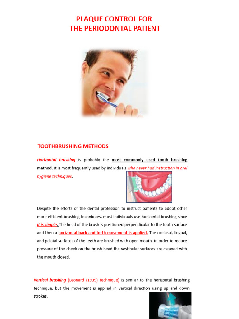 Stillman Technique for Plaque Control | PDF | Toothbrush | Human Tooth