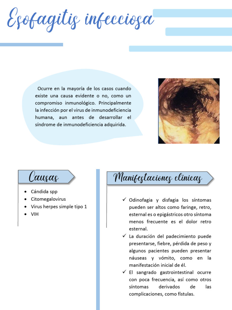 Esofagitis Infecciosa | Descargar gratis PDF | VIH | VIH / SIDA