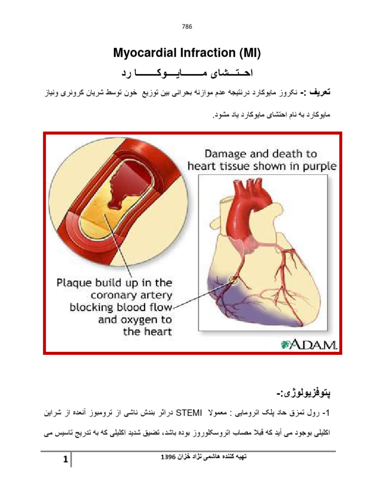 Myocardial Infraction | PDF