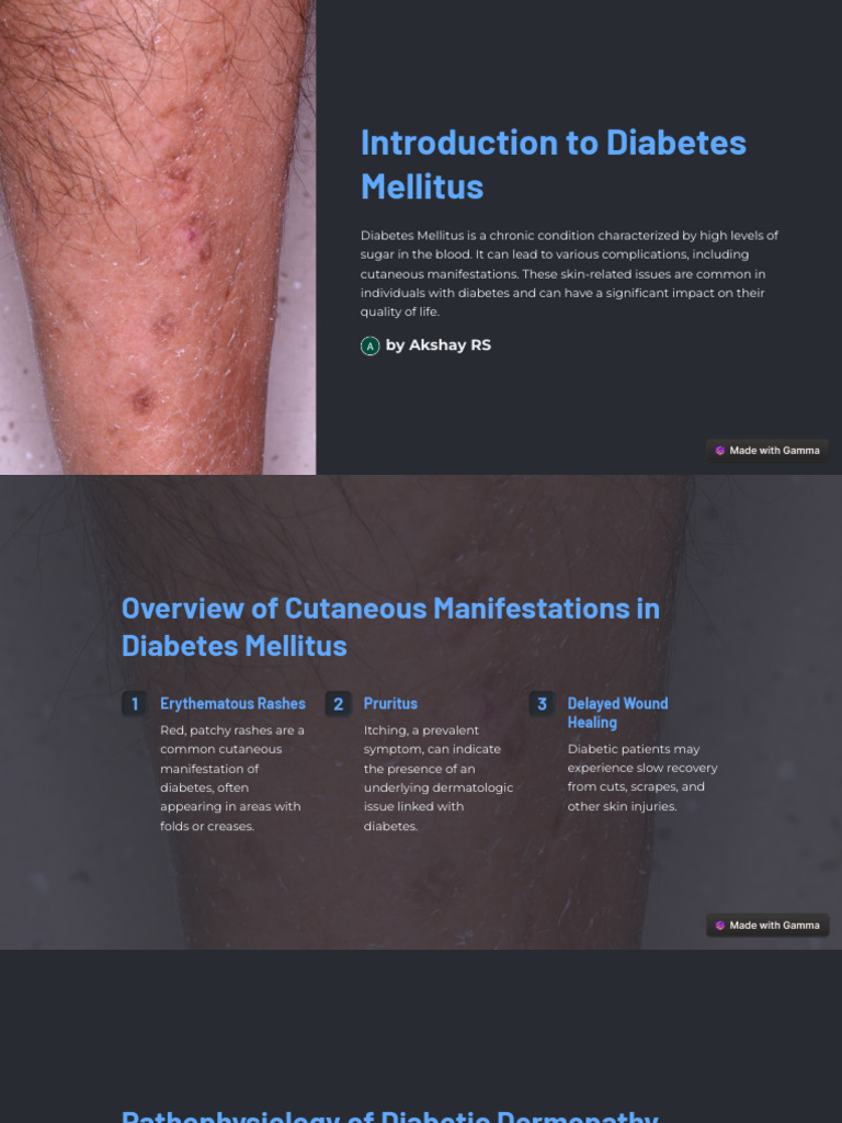 Introduction To Diabetes Mellitus | PDF | Peripheral Neuropathy | Diabetes