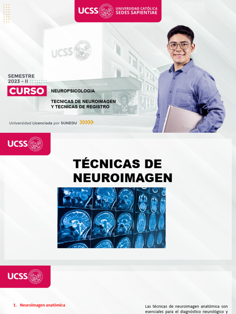 Ses.9 - Tecnicas de Neuroimagen | PDF | Neuroimagen | Ct Scan