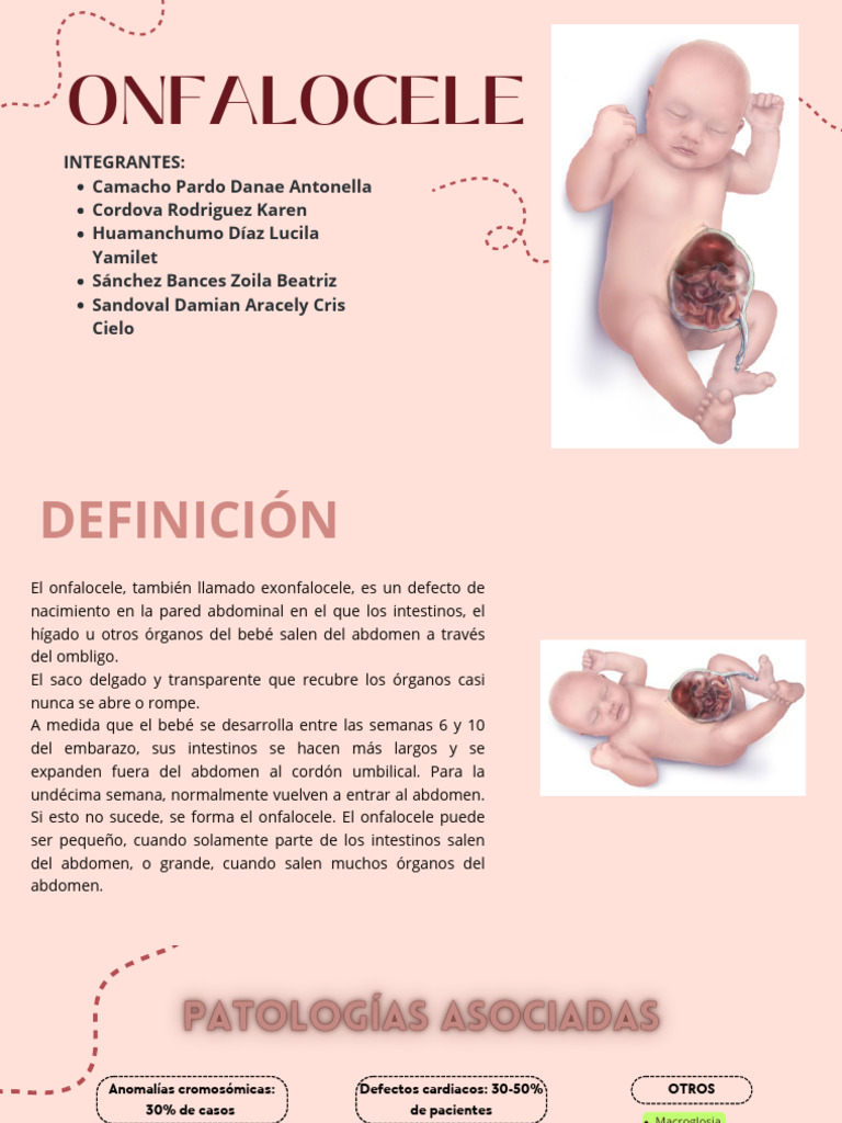 Onfalocele | PDF | Abdomen | El embarazo