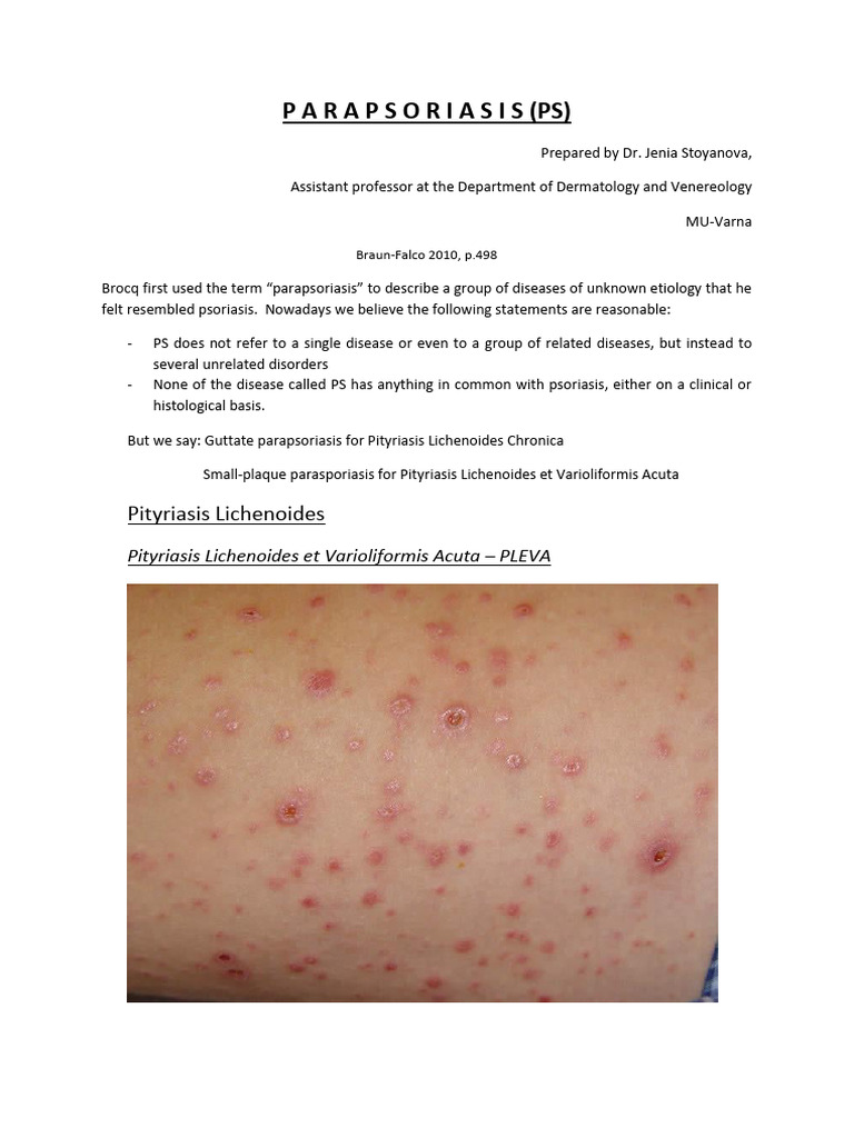 Parapsoriasis Pityriasis Rosea | PDF | Psoriasis | Health Sciences