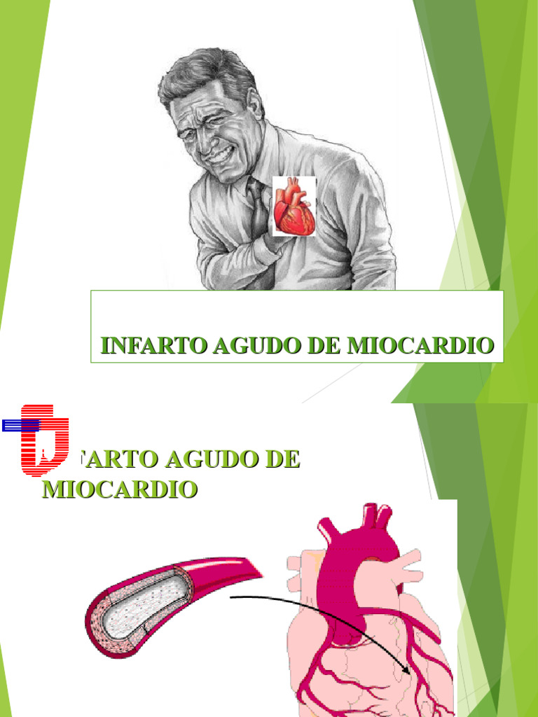 Cardio | PDF