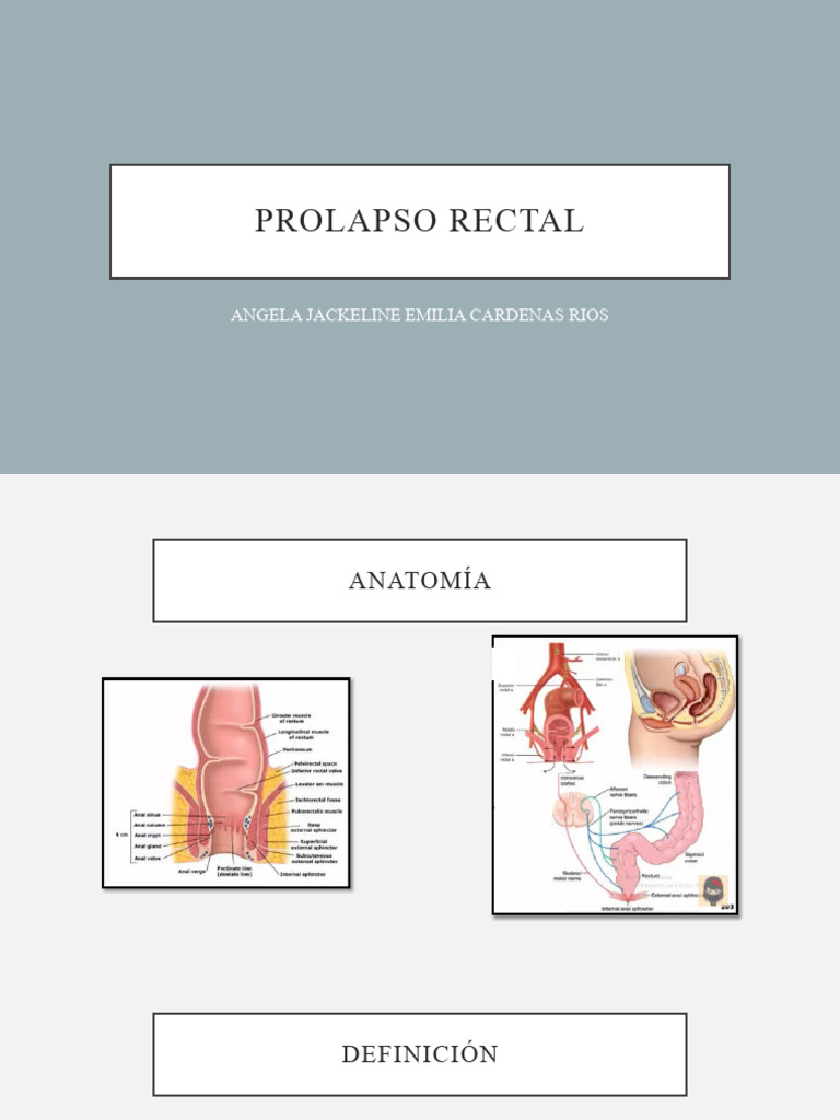 Prolapso Rectal | PDF | Estreñimiento | Hemorroides